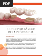 Tipos y funciones del póntico en prótesis fija | PDF | Dentadura ...