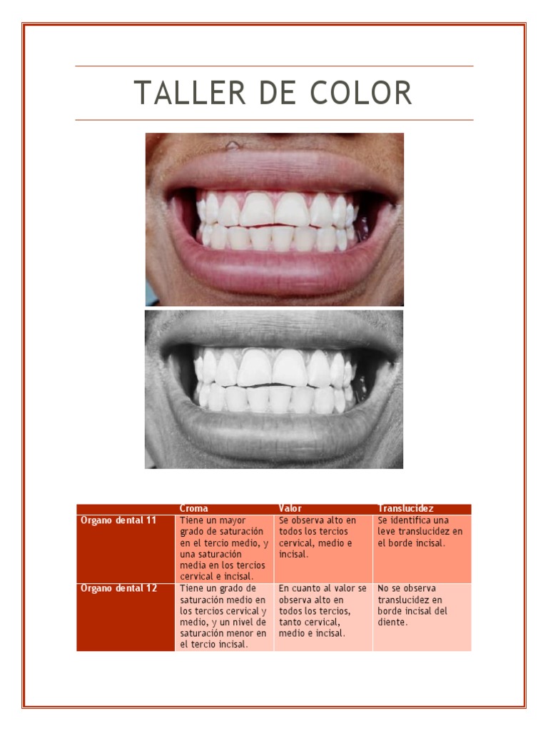 Análisis del color dental y su distribución en los diferentes tercios ...