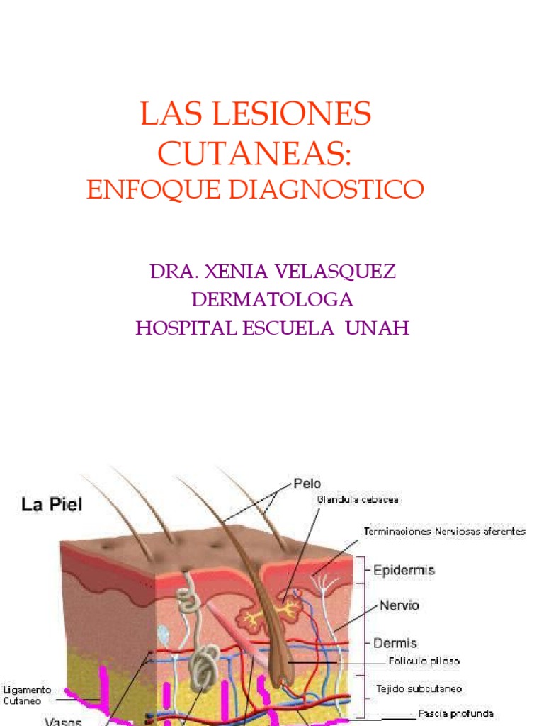 1.1 Lesiones Elementales Primarias y Secundarias. Enfoque Diagnostico ...