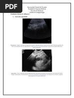 Protocolo Diagnóstico de Las Adenopatías Inguinales | PDF | Infección transmitida sexualmente ...