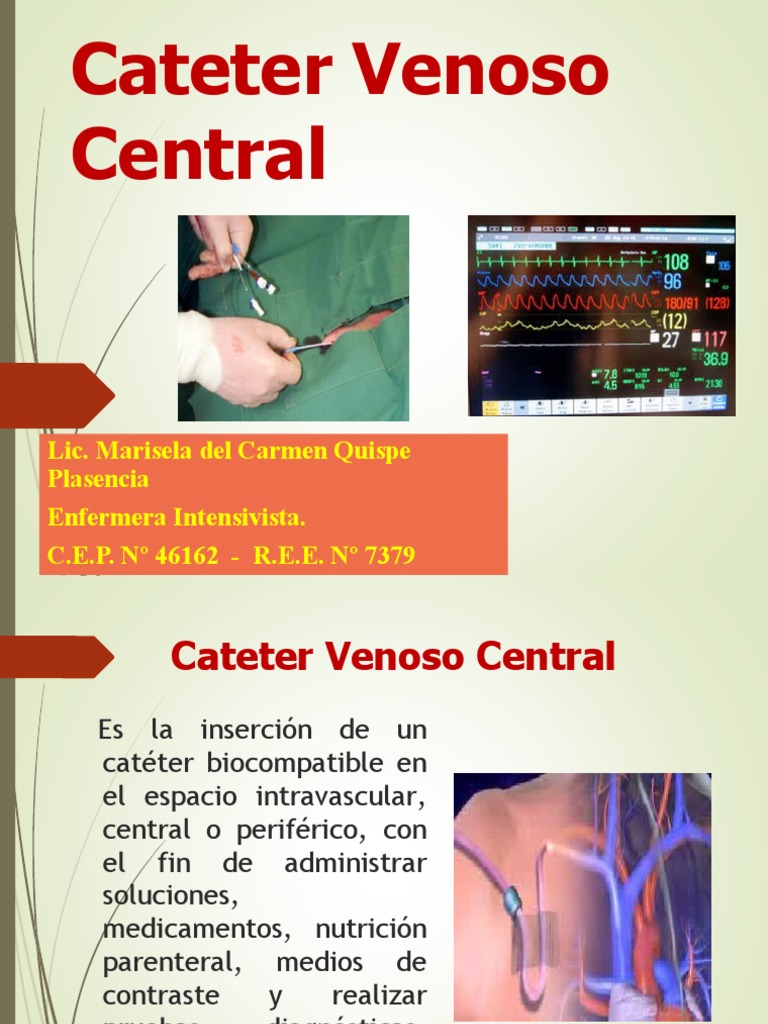 Cateter Venoso Central | PDF | Hemodinámica | Vena