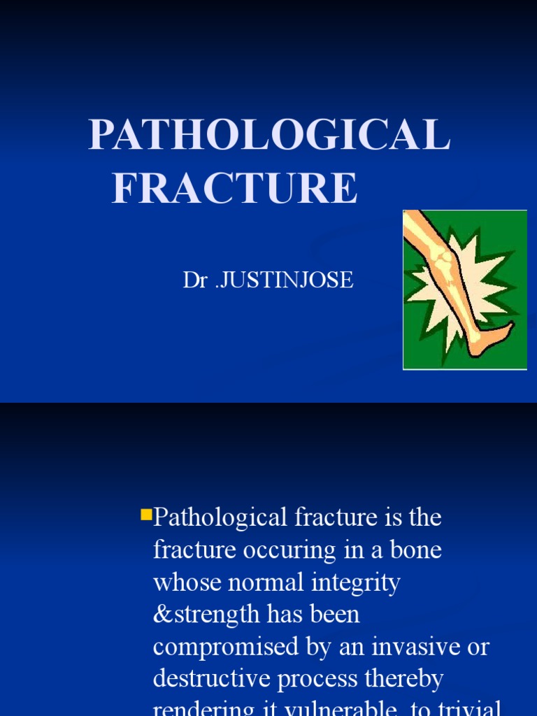 Pathological Fracture: DR .Justinjose | PDF | Bone | Multiple Myeloma