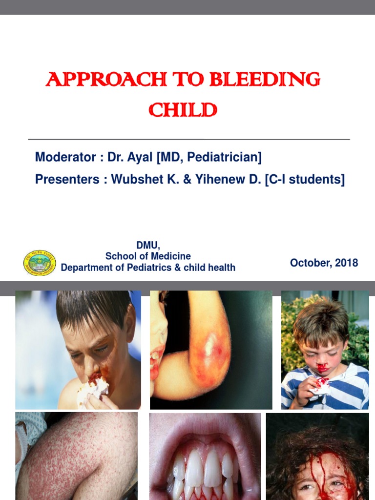 Approach To Bleeding Child: Moderator: Dr. Ayal (MD, Pediatrician ...