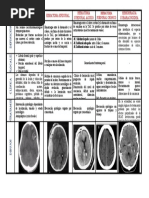 Ortoforia, Endoforia, Exoforia | PDF | Visión | Oftalmología