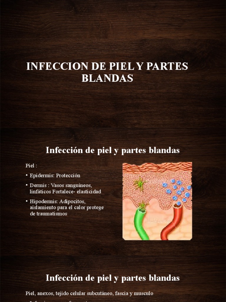 Infeccion de Piel y Partes Blandas | PDF | Piel | Patologia clinica