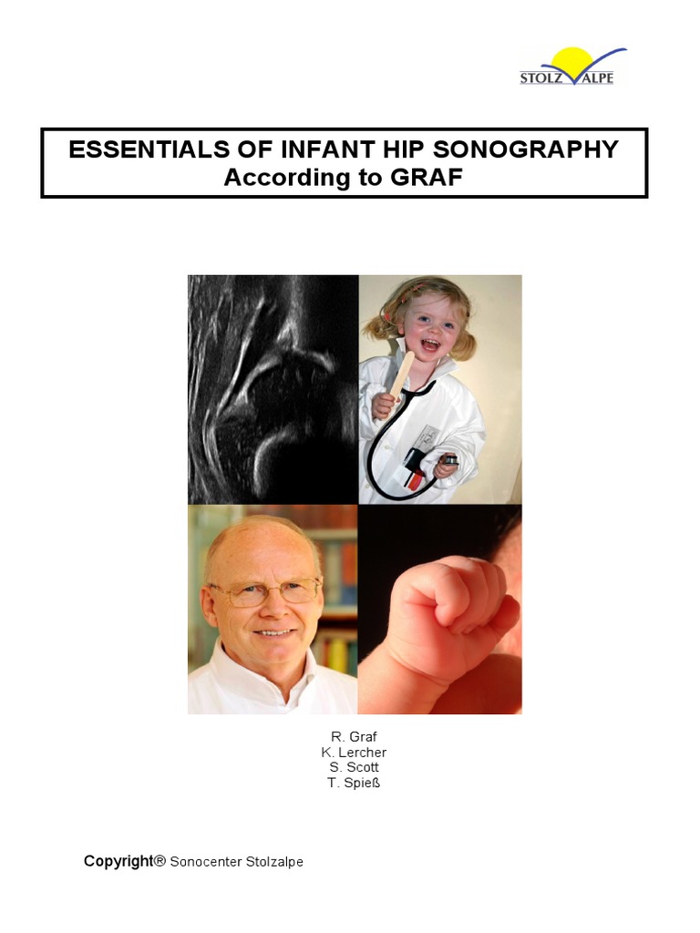 Essentials of Infant Hip Sonography According To GRAF: R. Graf K ...