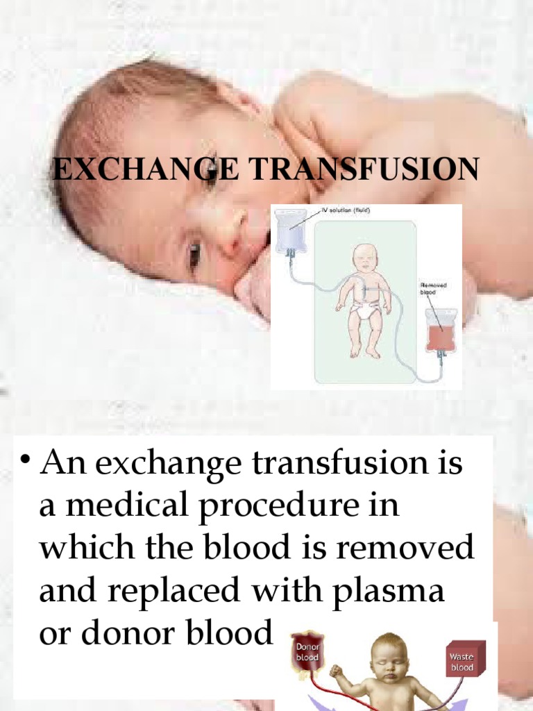 Exchange Transfusion | PDF | Blood Transfusion | Blood