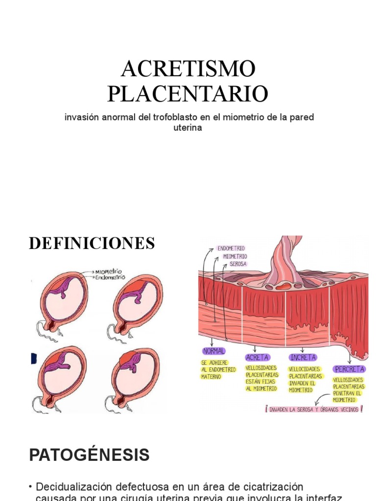 Acretismo Placentario | PDF | Placenta | El embarazo