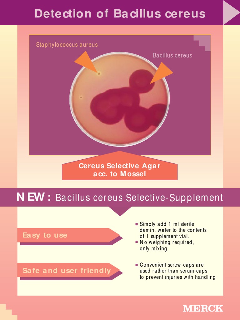 Detection of Bacillus cereus using selective agar | PDF | Bacillus | Agar