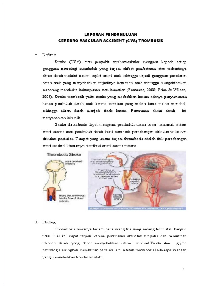 (PDF) LP CVA Thrombosis | PDF