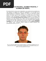 Análisis de Moyers | PDF | Boca | Ramas de Odontología