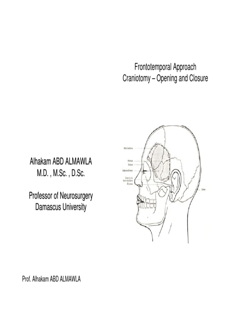 Frontotemporal Approach Craniotomy - Opening and Closure | PDF ...