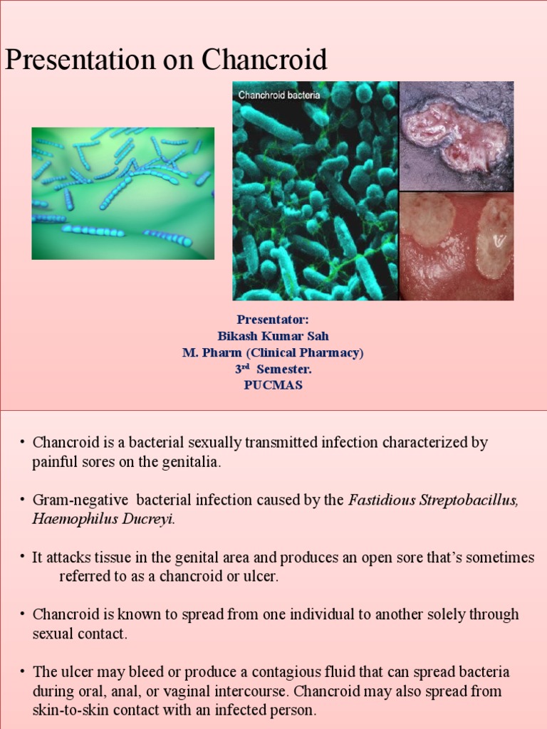 Presentation on Chancroid: Bacterial STI Causes Painful Genital Ulcers ...
