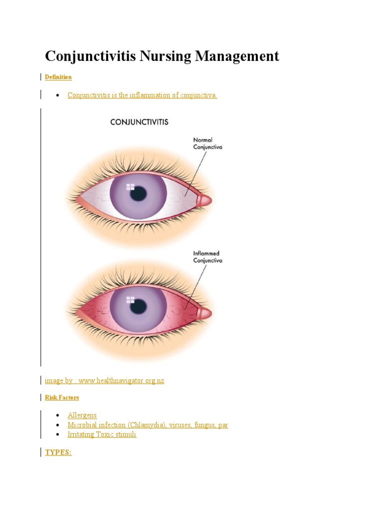 Conjunctivitis Nursing Management | PDF | Public Health | Microbiology