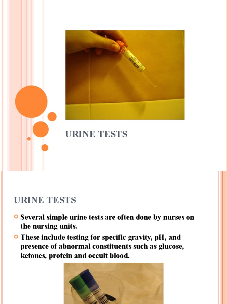 Urine Test | PDF | Urine | Glucose