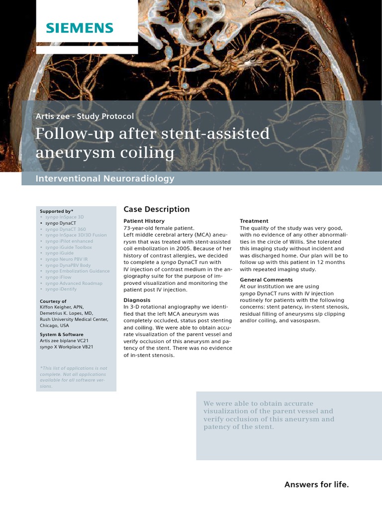 Neuro - 2014 Follow-Up After Stent Assisted Aneurysm Coiling With ...