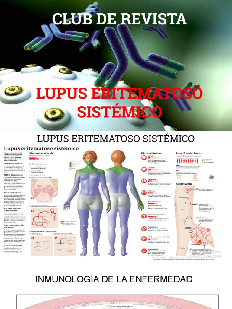 Presentación Hospital (Lupus) | PDF | Medicina CLINICA | Enfermedades y trastornos