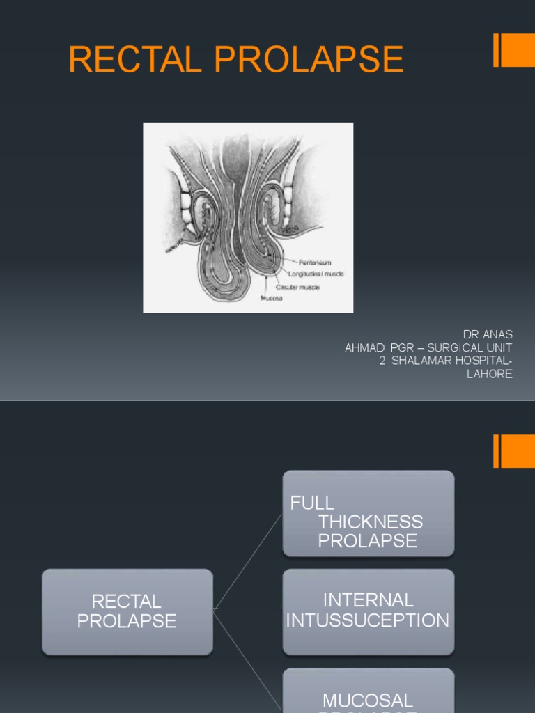 Rectal Prolapse: Types and Treatments | PDF | Rectum | Digestive System