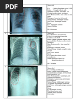 Analisis Foto Rontgen Thorax dan Abdomen | PDF