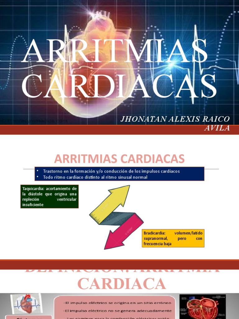 ARRITMIAS | PDF | Enfermedades cardiovasculares | Enfermedades y trastornos