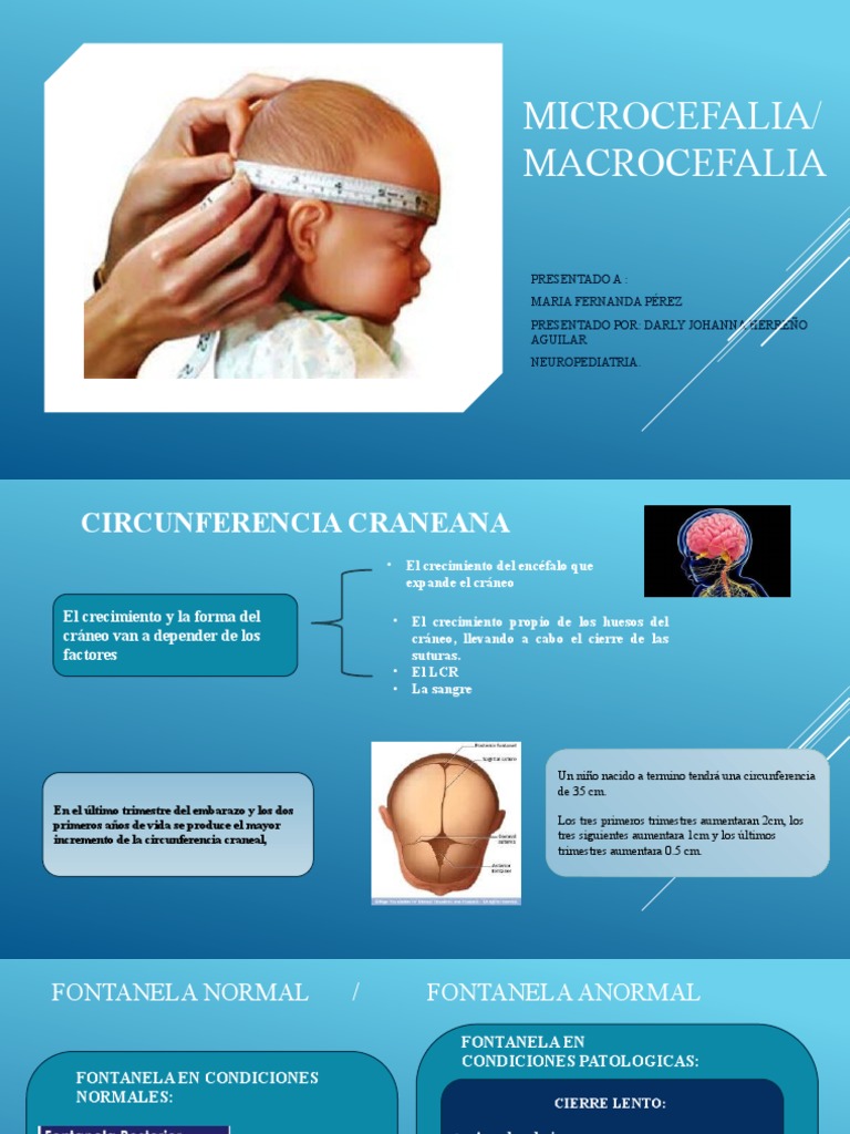 MICROCEFALIA | PDF | Especialidades Medicas | Epidemiología