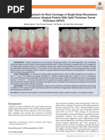 Miller Classification of Tissue Recession | PDF | Periodontology ...
