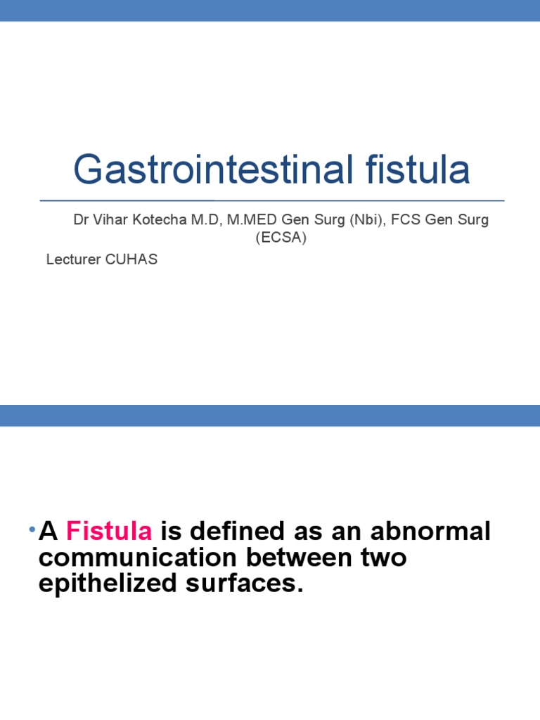 Overview of Gastrointestinal Fistulas | PDF | Gastrointestinal Tract ...