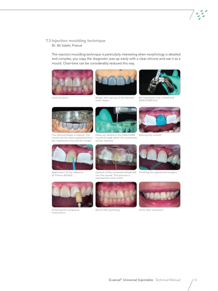 Injection Moulding Technique PDF | PDF Injection Moulding Technique PDF | PDF