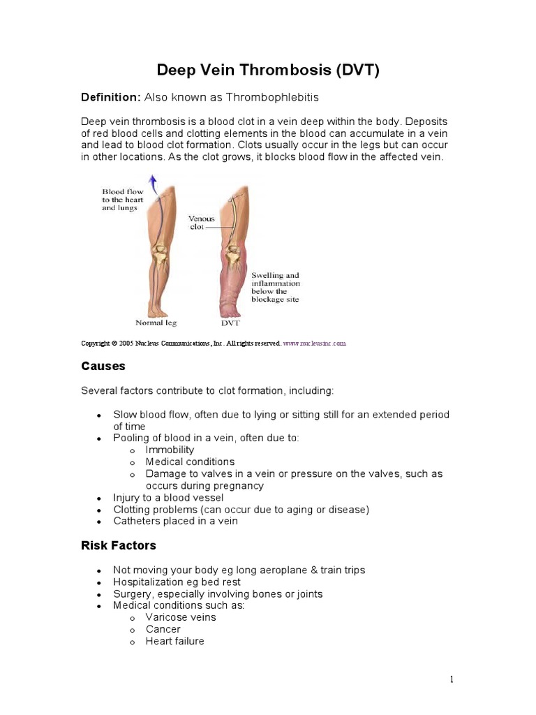 Deep Vein Thrombosis | PDF | Thrombosis | Vein