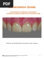 Bonding Day Protocol For Emax & Zirconia | PDF | Materials