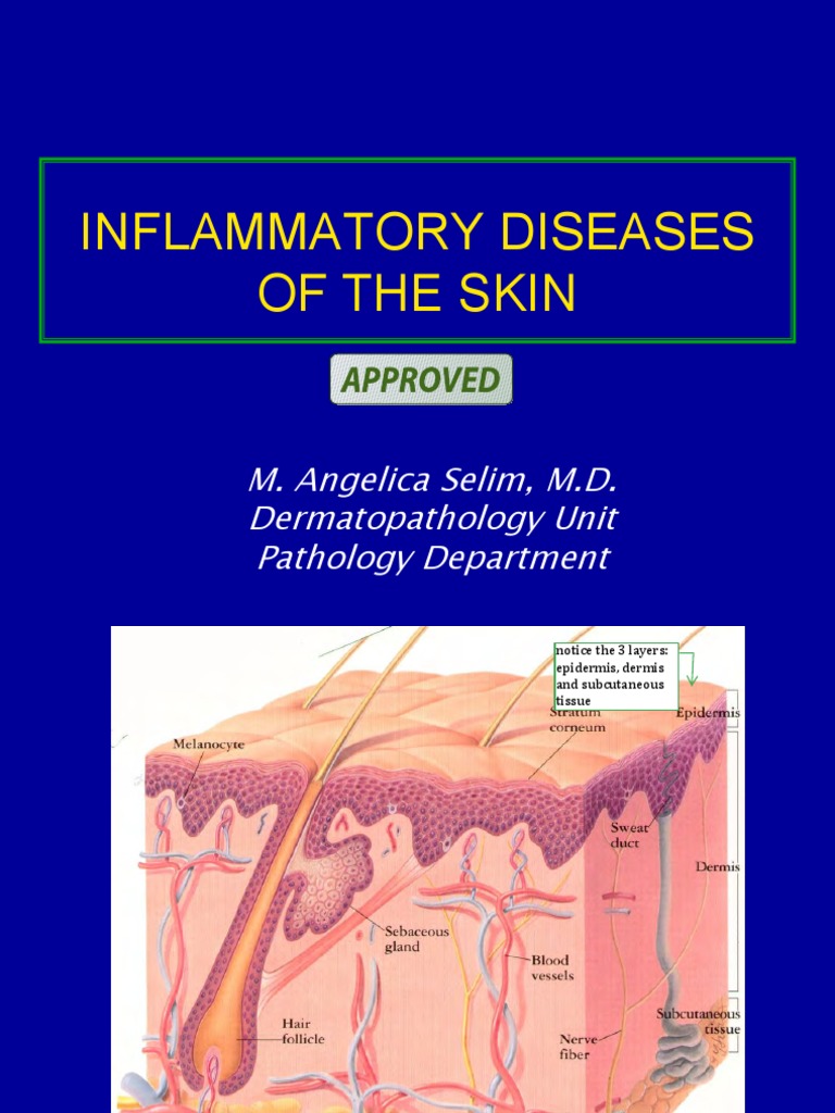 Inflammatory Diseases of The Skin: M. Angelica Selim, M.D ...