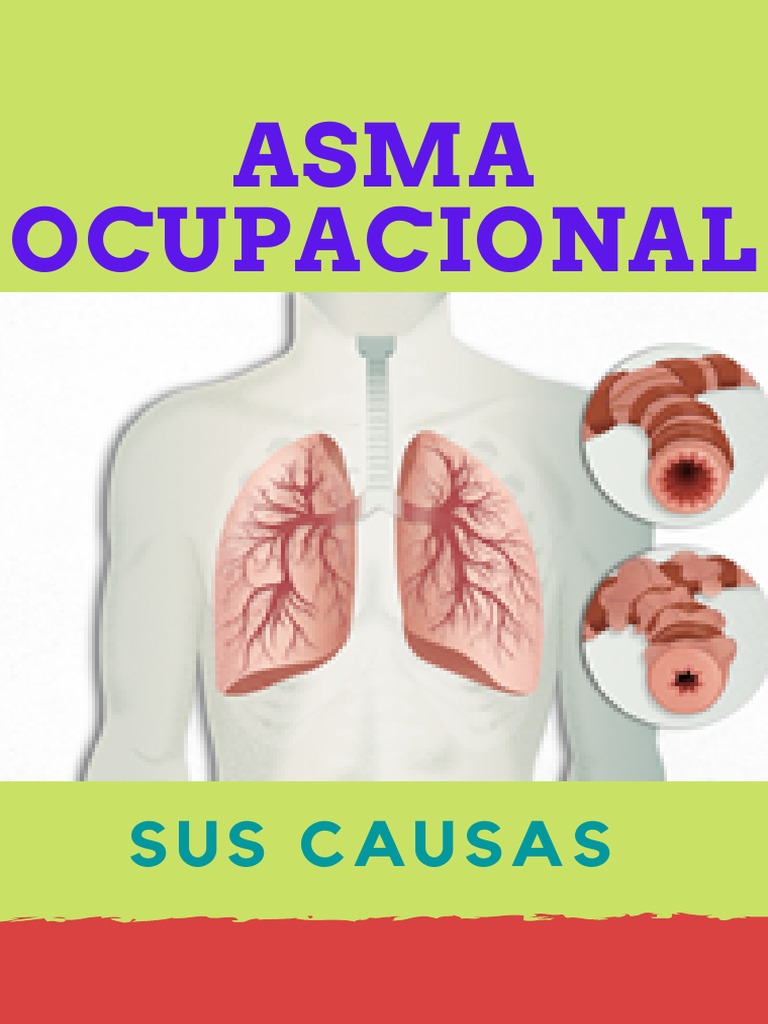 Asma Ocupacional Folleto | PDF