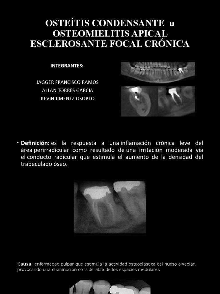 Osteítis Condensante Imagenologia | PDF | Hueso | Osteoblastos