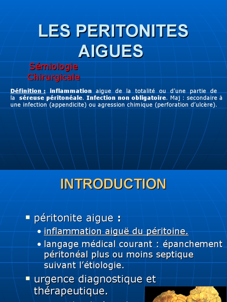 Les Peritonites Aigues2 | PDF | Péritoine | Douleur