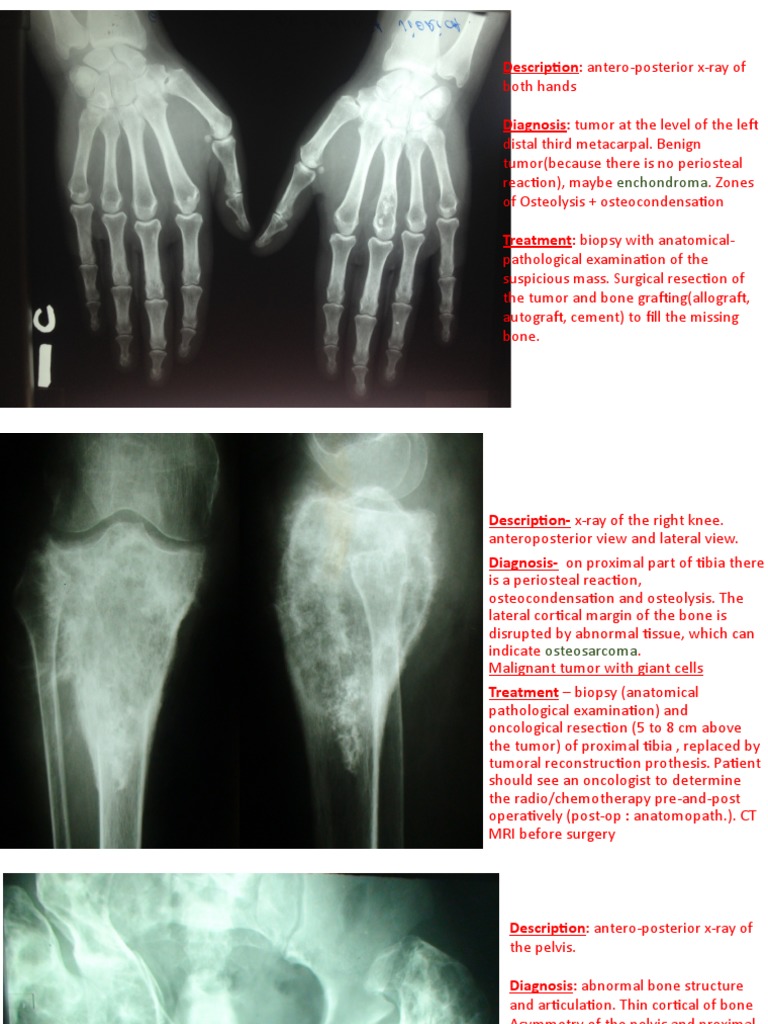 X Rays and Topics 2020 | PDF | Hip | Knee