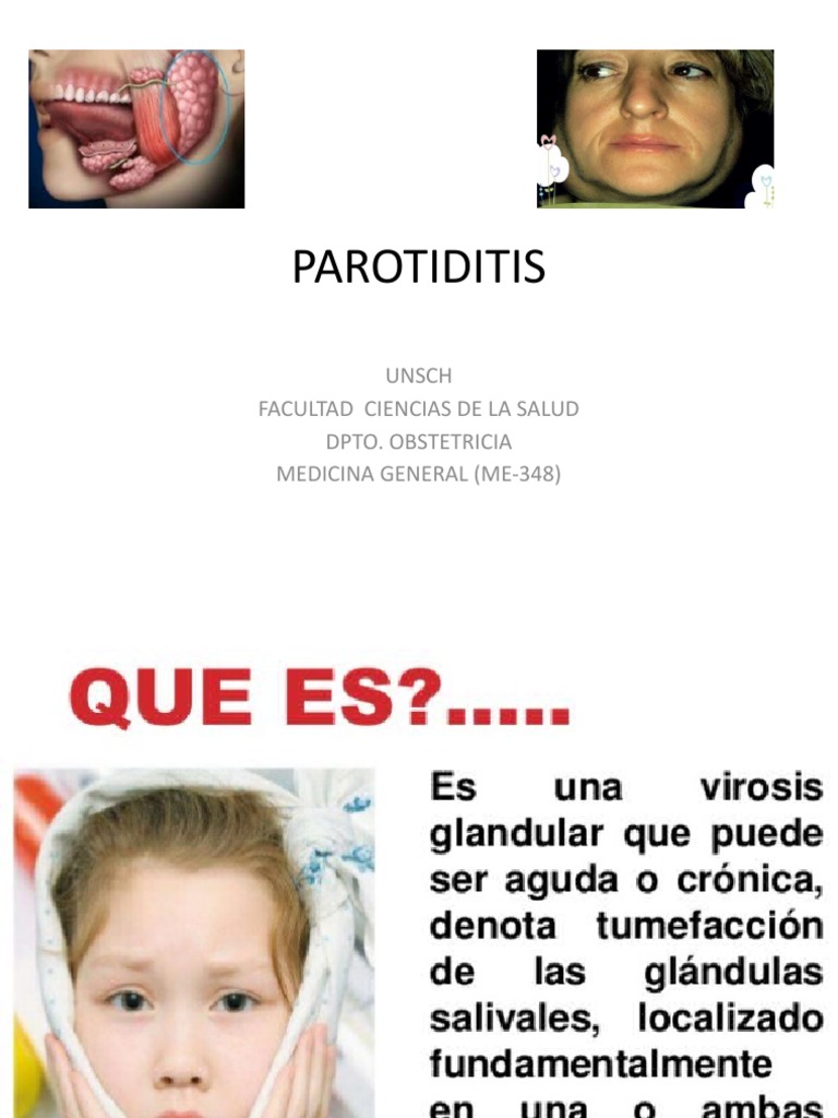 PAROTIDITIS | PDF | Salud y bienestar | Ciencia y matemáticas