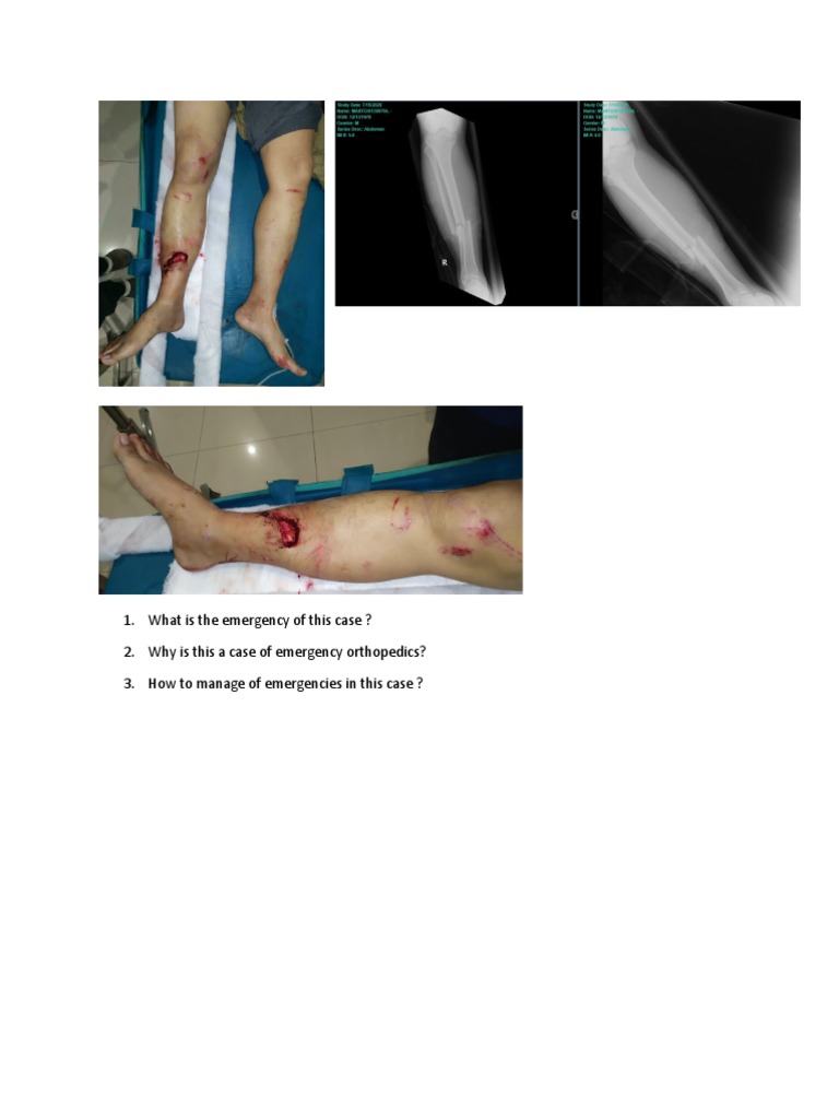 Exam | PDF | Orthopedic Surgery | Surgery