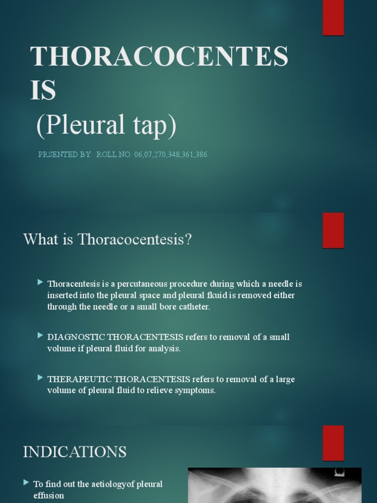 Pleural Tap | PDF | Medical Specialties | Clinical Medicine