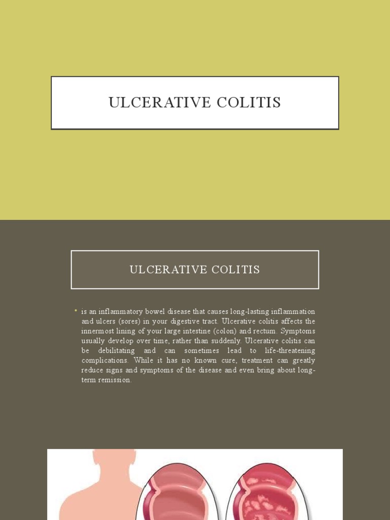 Ulcerative Colitis | PDF | Ulcerative Colitis | Gastroenterology