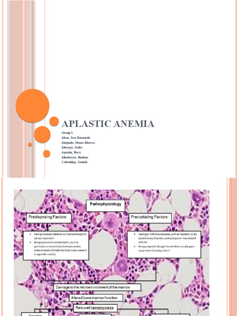 A Comprehensive Overview of Aplastic Anemia Covering Its Signs and ...