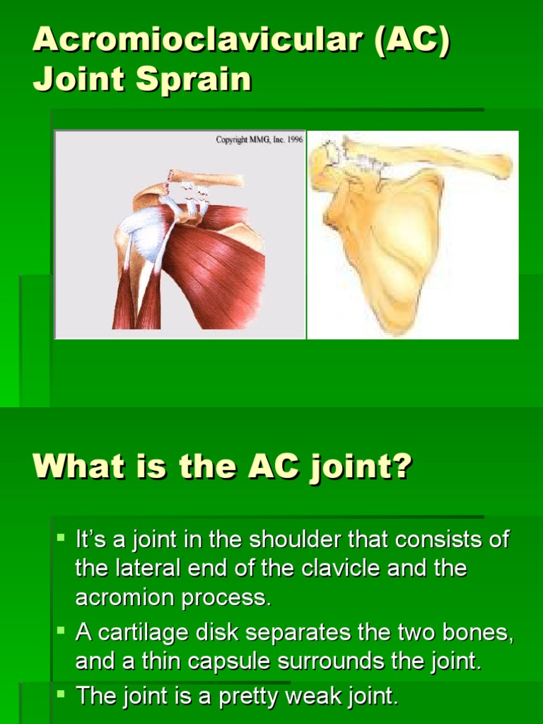 Acromioclavicular Ac Joint Sprain | PDF