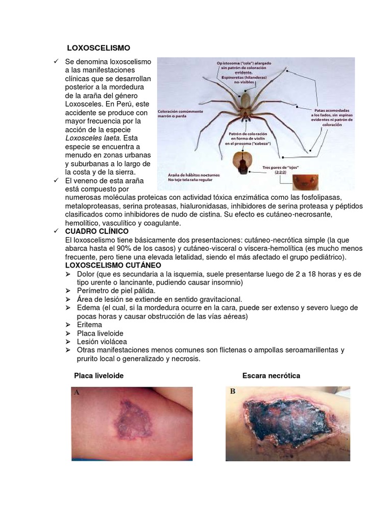 LOXOSCELISMO - Guía de Infección e Inmunidad | PDF | Especialidades ...
