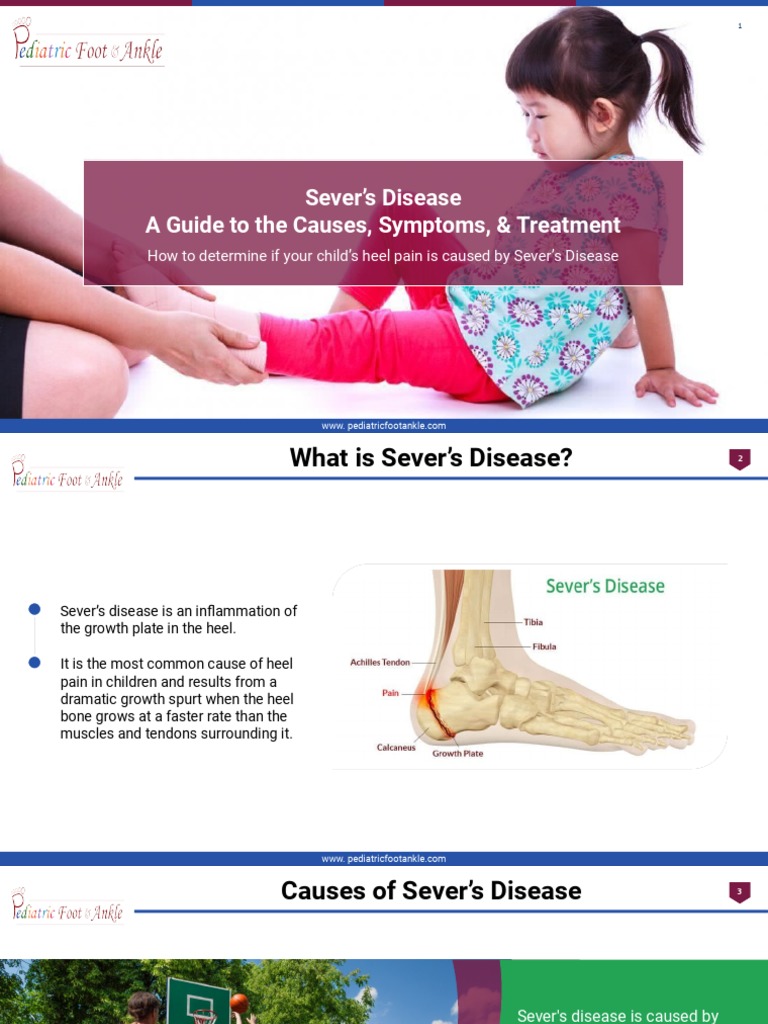 Sever's Disease A Guide To The Causes, Symptoms, & Treatment | PDF | Edema | Foot