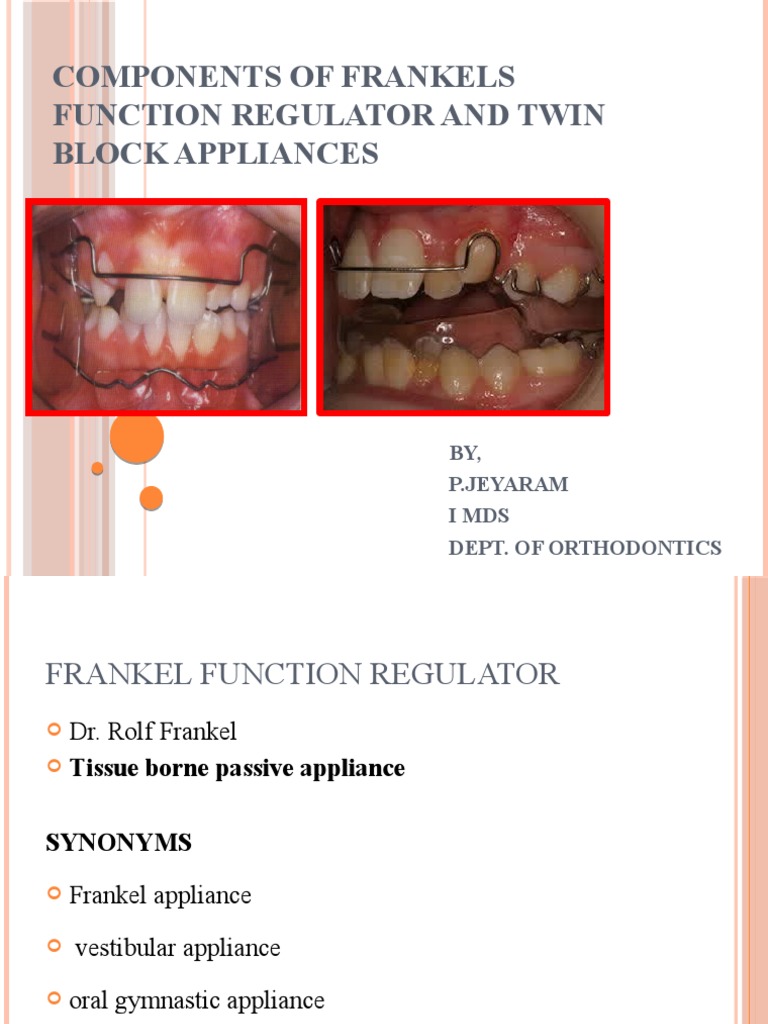 Components of Frankels Function Regulator and Twin Block | PDF | Tooth ...