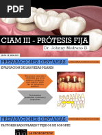 Efecto Ferula en Protesis Fija | PDF | Dentadura postiza | Boca