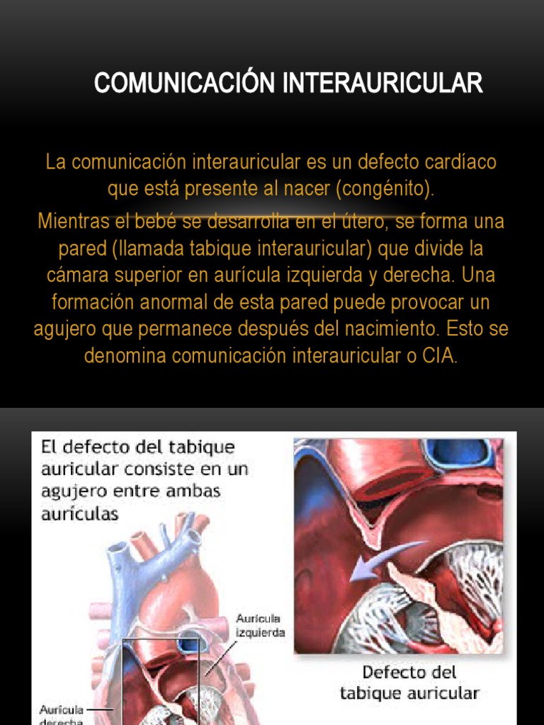 Comunicación Interauricular | PDF | Enfermedades cardiovasculares | Corazón