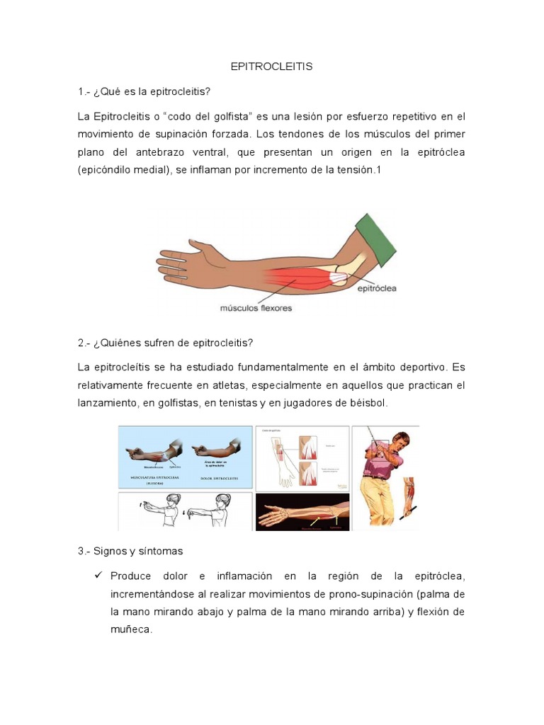 Epitrocleitis Word | PDF | Codo | Dolor