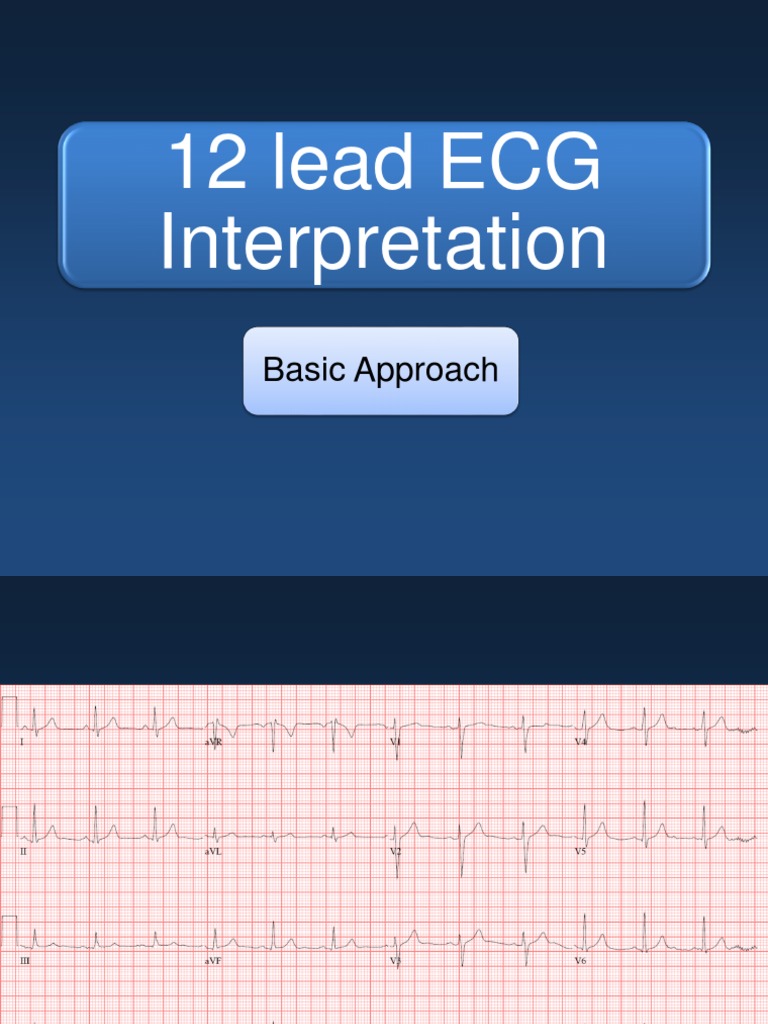 07.01 - 12 Lead ECG Interpretation 2019 | PDF | Electrocardiography ...