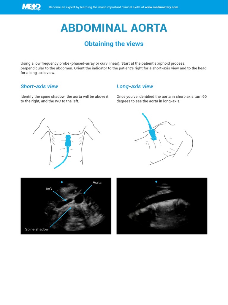 Obtaining The Views | PDF