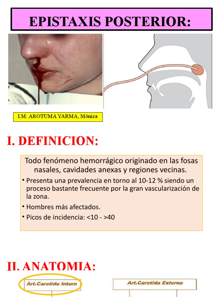 EPISTAXIS | PDF | Especialidades Medicas | Medicina CLINICA